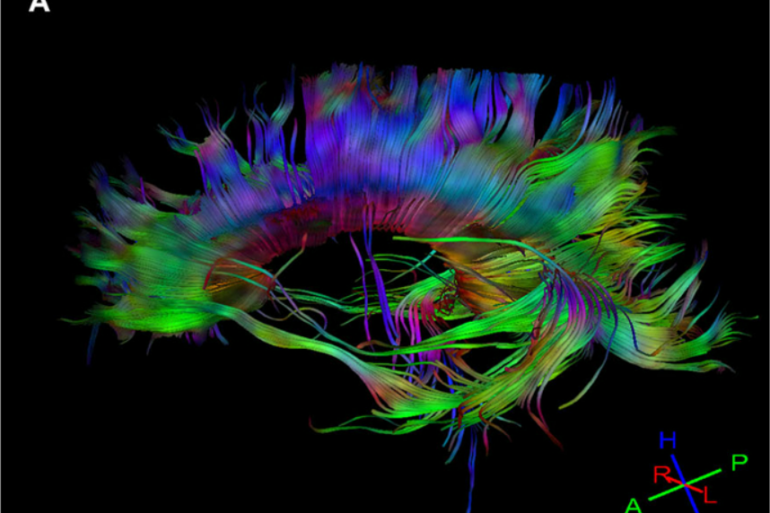 The Legitimacy of Parapsychology as A Science - Science & Psi